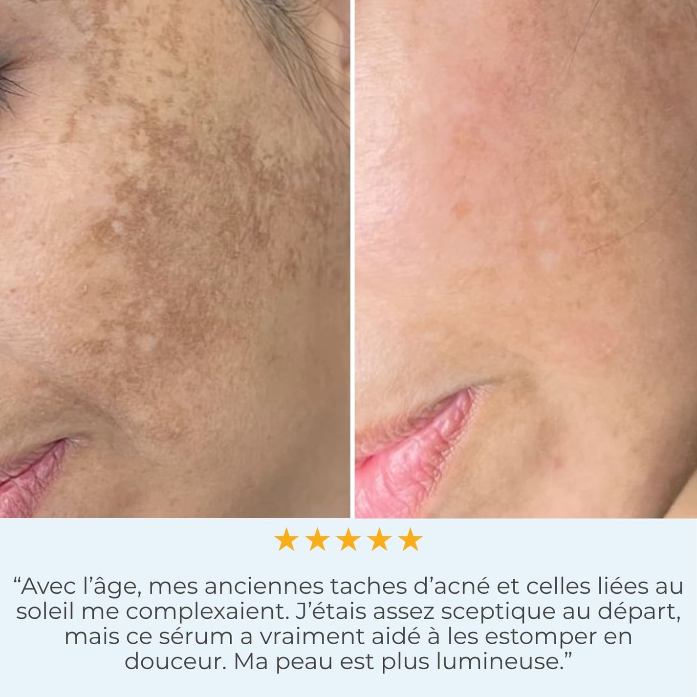 Ouvrir le média 8 dans une fenêtre modale