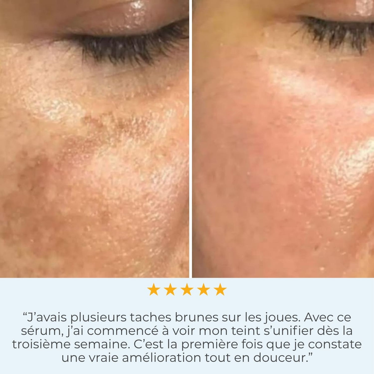 Ouvrir le média 10 dans une fenêtre modale